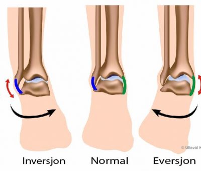 Senebetennelse i ankelen | Ullevål Kiropraktorklinikk