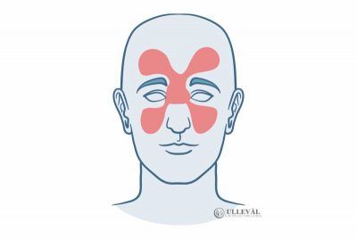 De 10 vanligste hodepinene | Ullevål Kiropraktorklinikk